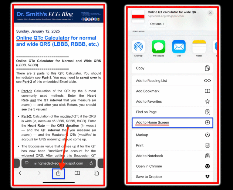 Online QTc Calculator for normal and wide QRS (LBBB, RBBB, etc.) - Dr ...
