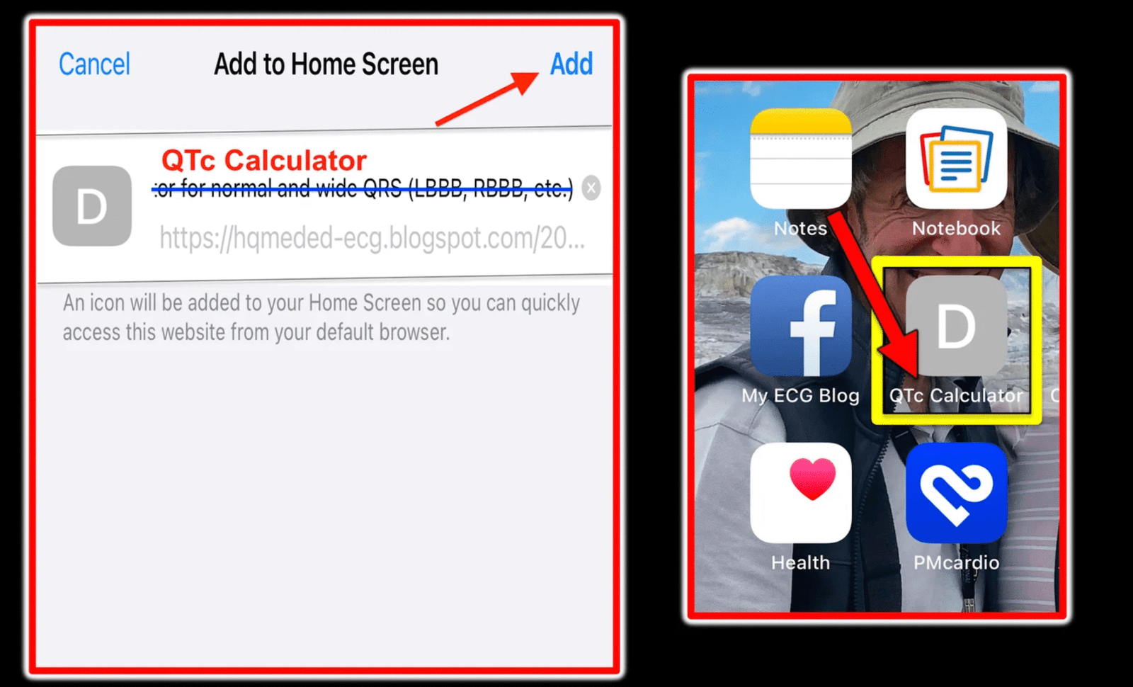 Online QTc Calculator for normal and wide QRS (LBBB, RBBB, etc.) - Dr ...