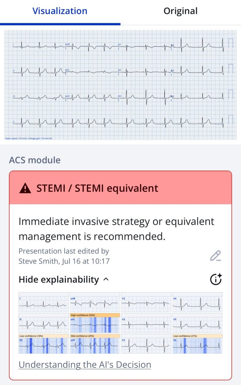 Is it Always Best to Activate when Convinced of Acute OMI in a STEMI ...