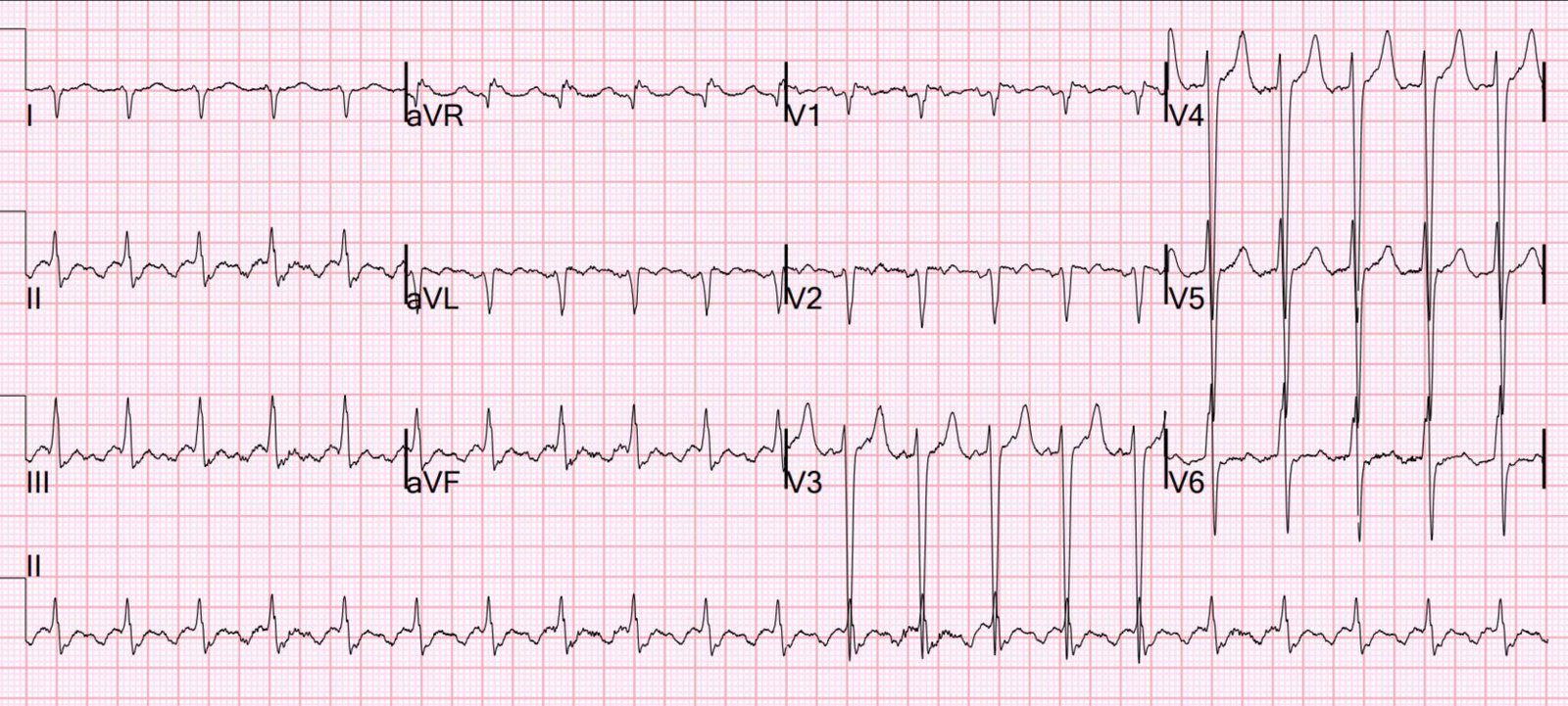 Several days of Shortness of breath. Other than the obvious atrial ...