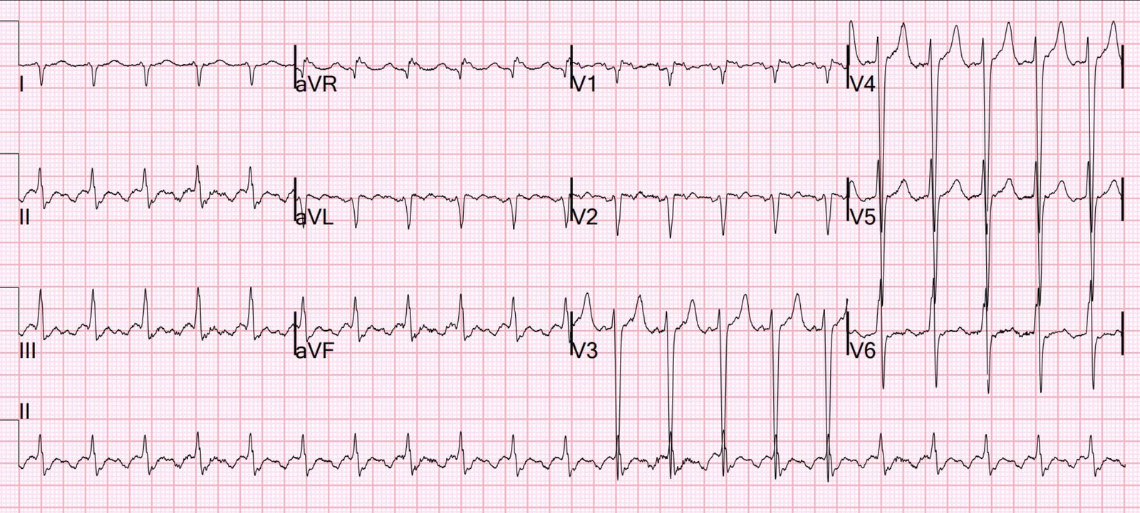 Several days of Shortness of breath. Other than the obvious atrial ...