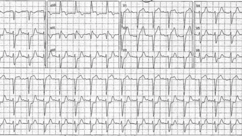 Dr. Smith’s ECG Blog - Page 2 of 196 - Expert ECG Interpretation and ...
