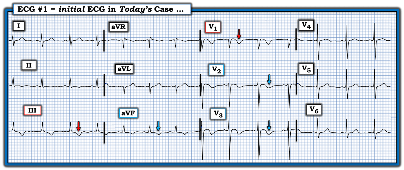 ECG interpretation can keep you out of the courtroom. And "viral ...