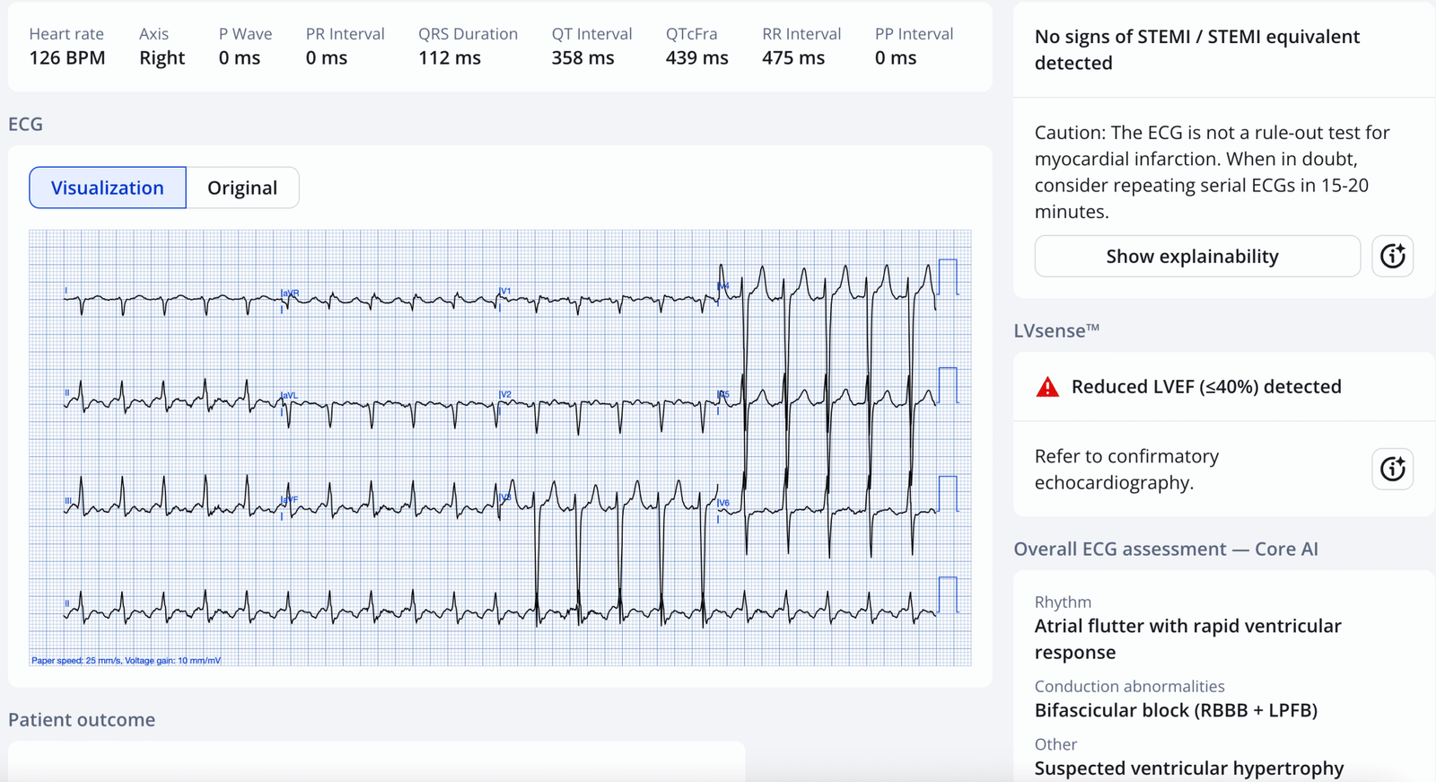 Several days of Shortness of breath. Other than the obvious atrial ...