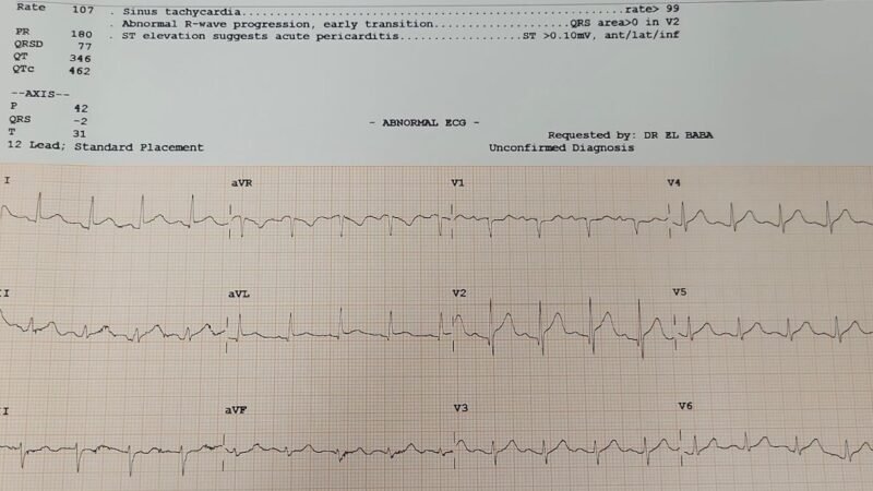 Dr. Smith’s ECG Blog - Page 2 of 198 - Expert ECG Interpretation and ...