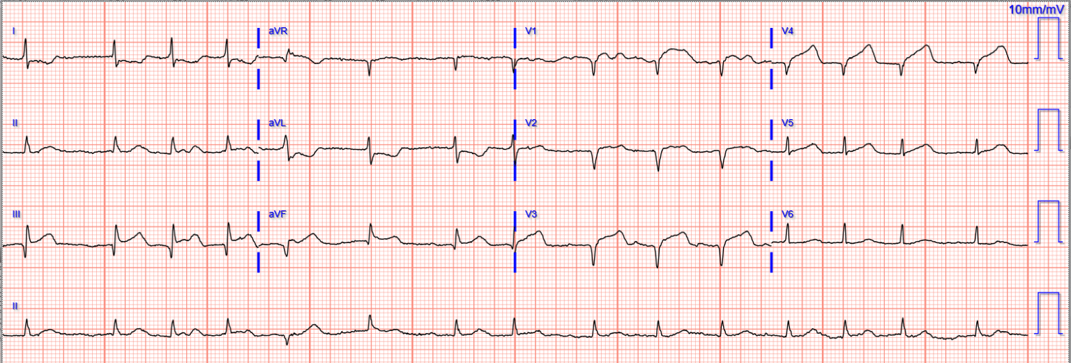 What do you think happened to this woman with chest pain? - Dr. Smith’s ...