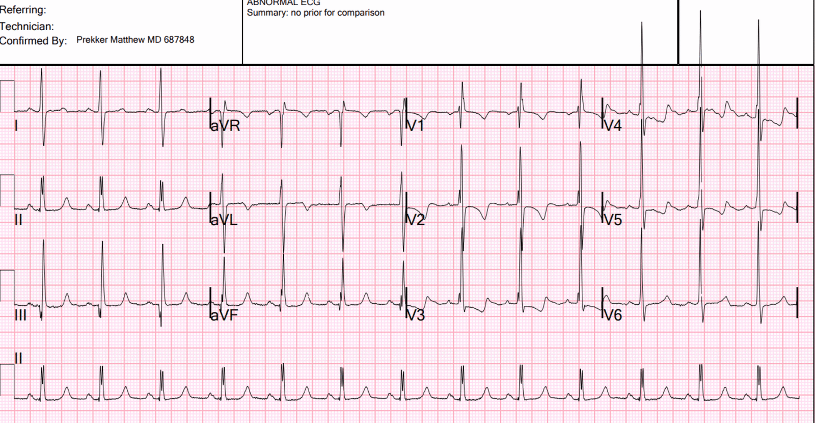 Dyspnea and chest pain. O2 saturation 88%. - Dr. Smith’s ECG Blog