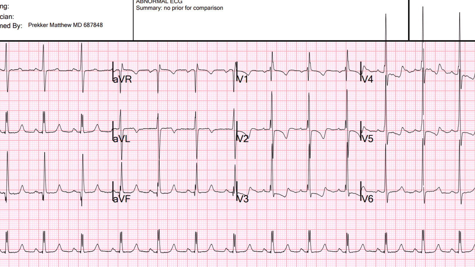 Steve Smith, Author at Dr. Smith’s ECG Blog