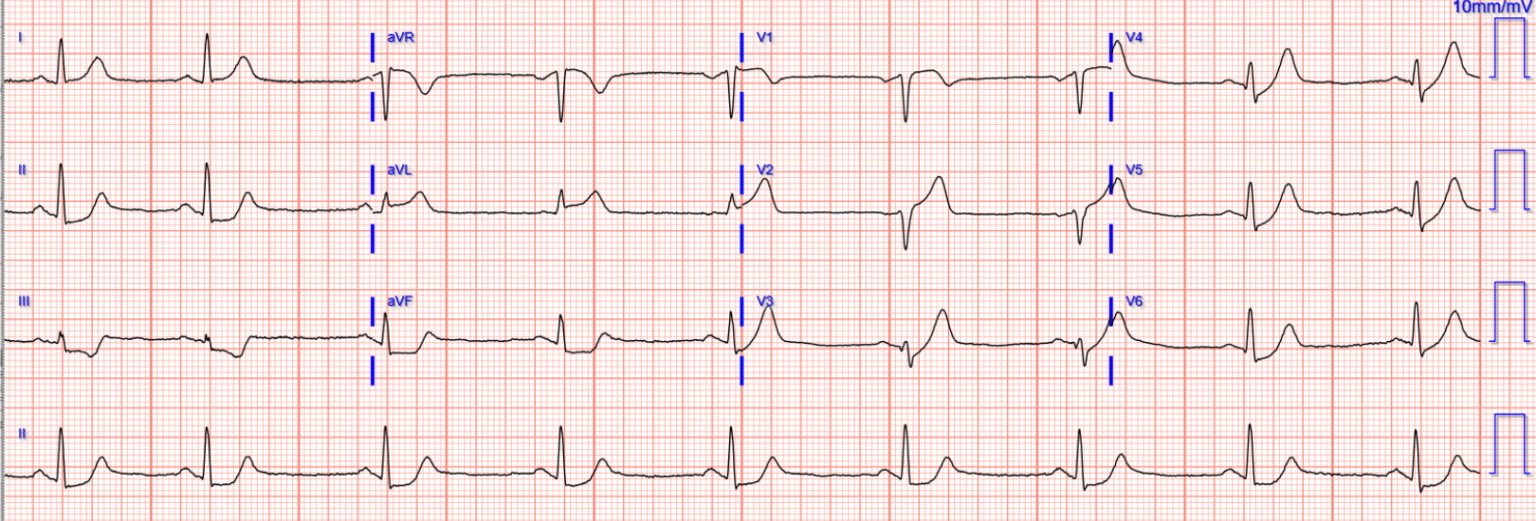 A man in his 50s with chest pain. You must strongly advocate for your ...