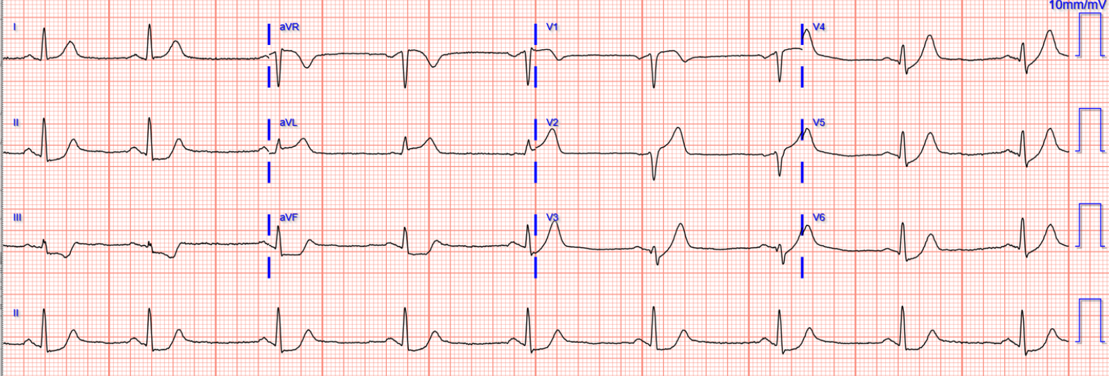 A man in his 50s with chest pain. You must strongly advocate for your ...