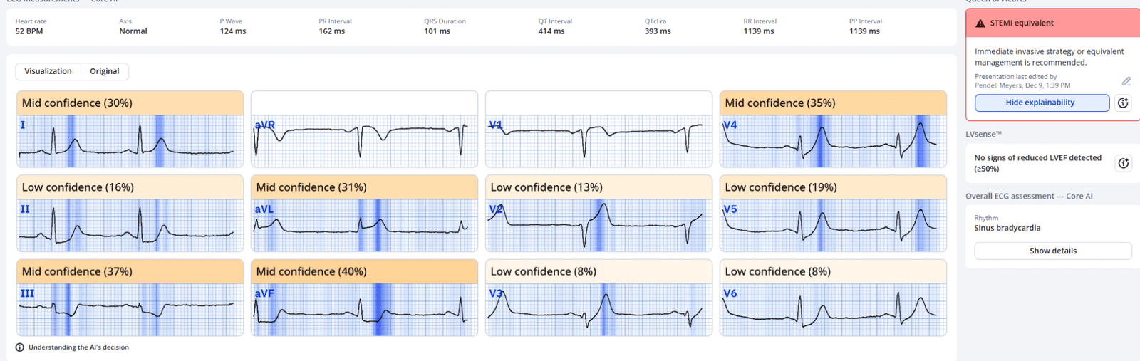 A man in his 50s with chest pain. You must strongly advocate for your ...