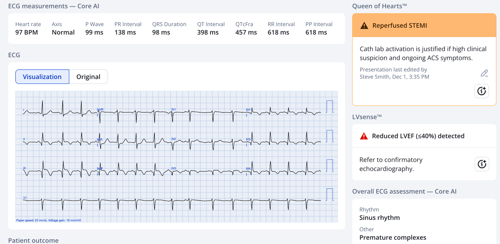 When should you get a CT scan on a STEMI patient to rule out aortic ...