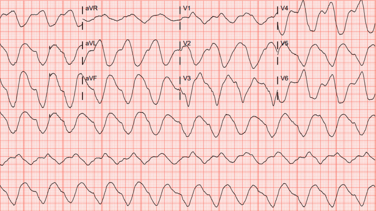 A man in his 50s with altered mental status and abdominal pain. What ...