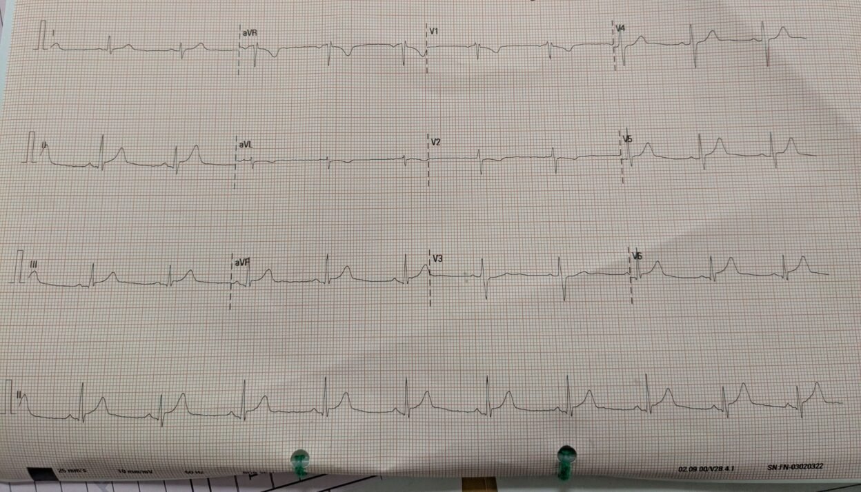 Signed off as "normal, no concern" - Dr. Smith’s ECG Blog