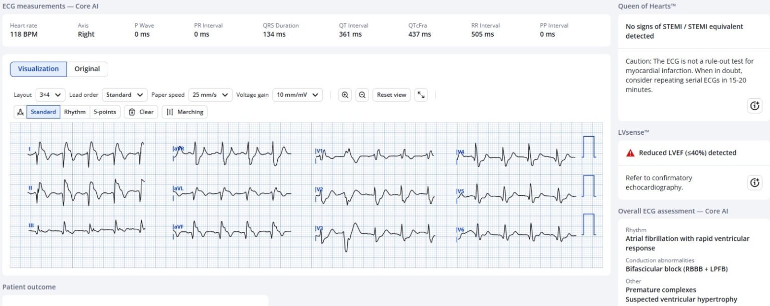 The Right Decision for the Wrong Reason? - Dr. Smith’s ECG Blog